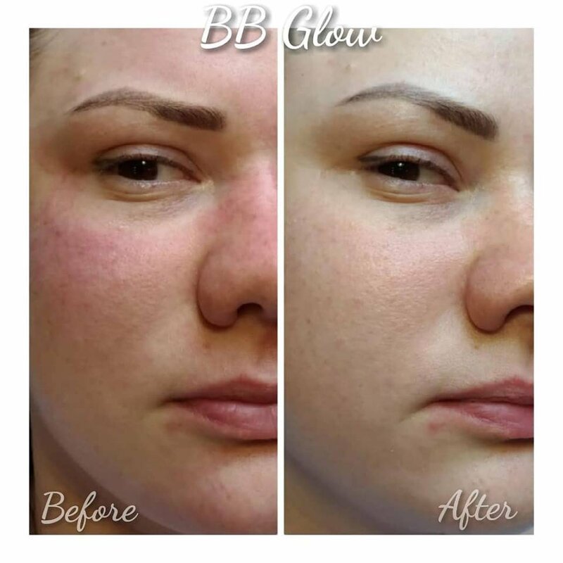 Bb Glow Foundation Natural Anti Ageing Clinic